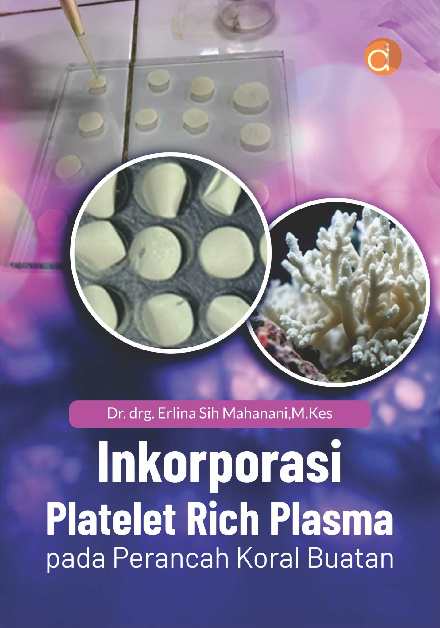 Inkorporasi Platelet Rich Plasma